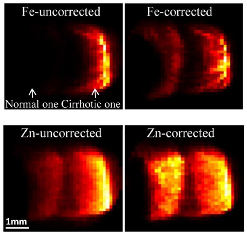 Latest advances of X-ray imaging and biomedical applications beamline ...