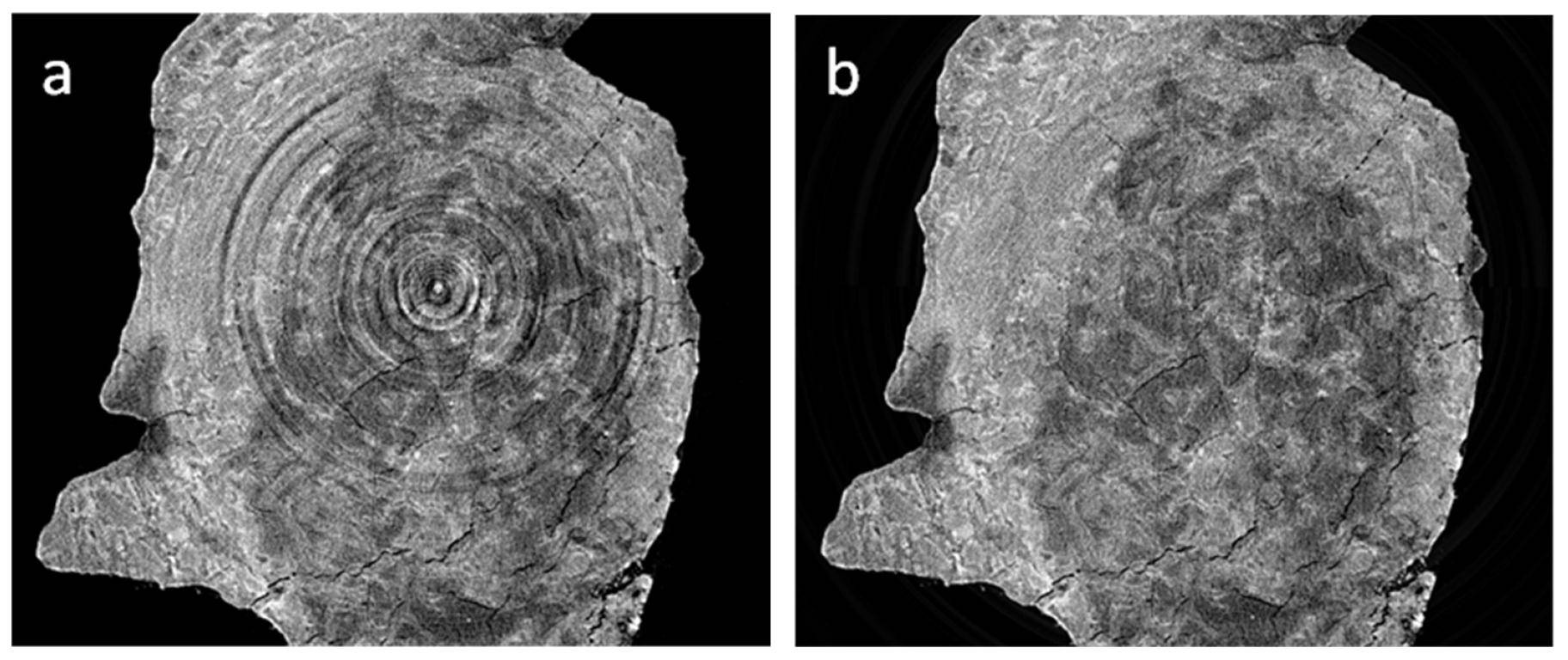 Latest advances of X-ray imaging and biomedical applications beamline ...