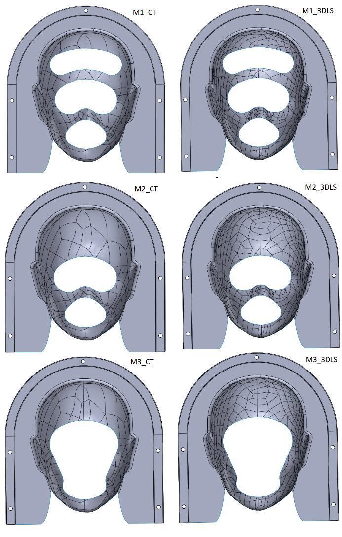 Radiotherapy customized head immobilization masks: from modeling and ...
