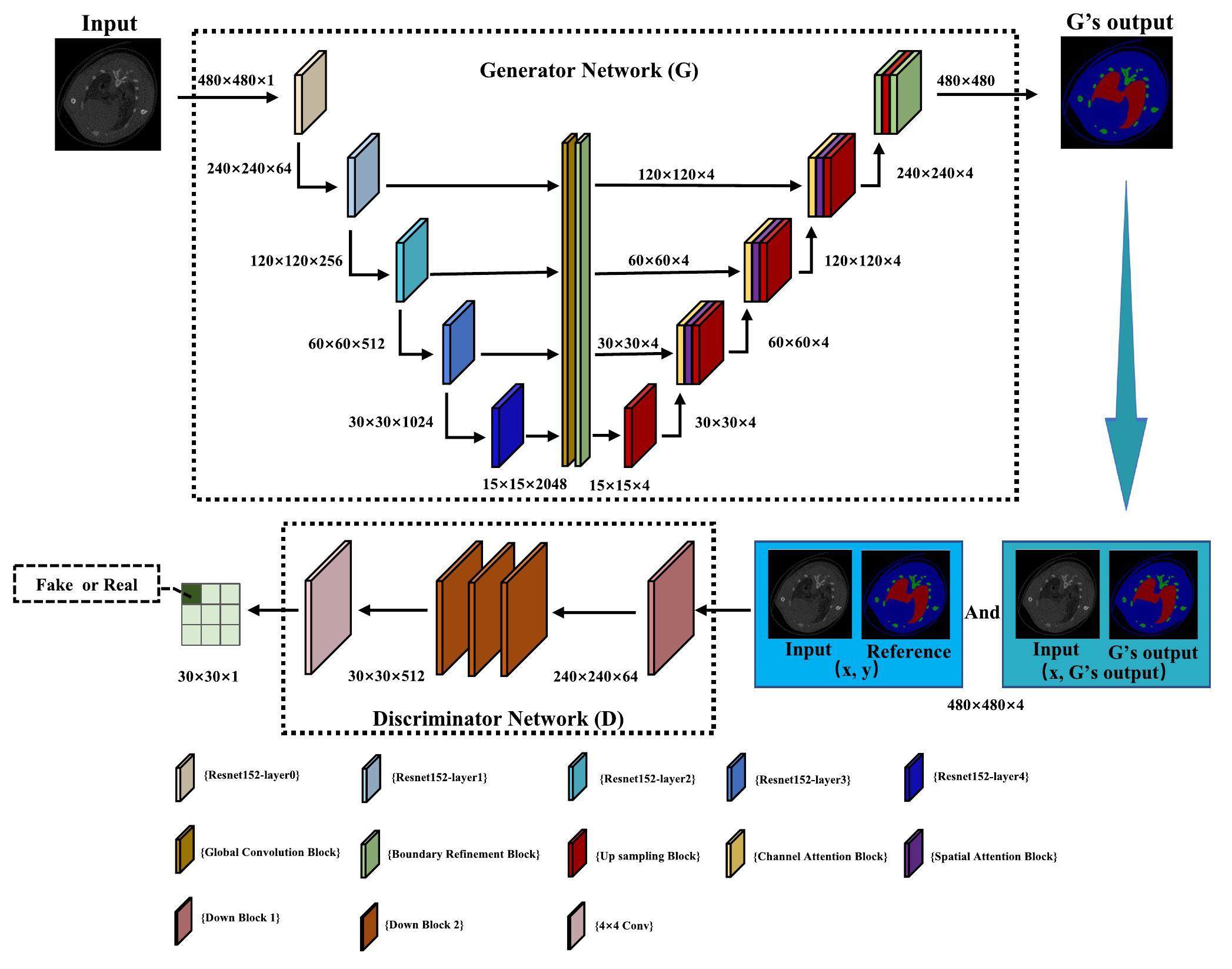 Material decomposition of spectral CT images via attention-based global ...